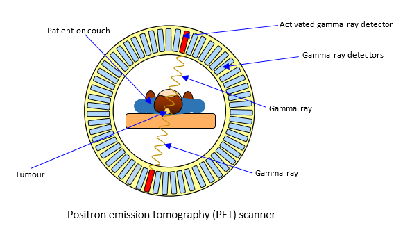 Pet Scanner Diagram